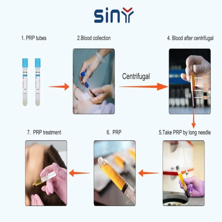 The Ultimate PRP Treatment Guide - Sinymedical PRP Tube