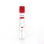 The Difference Between ACD-A and ACD-B in PRP - Siny PRP