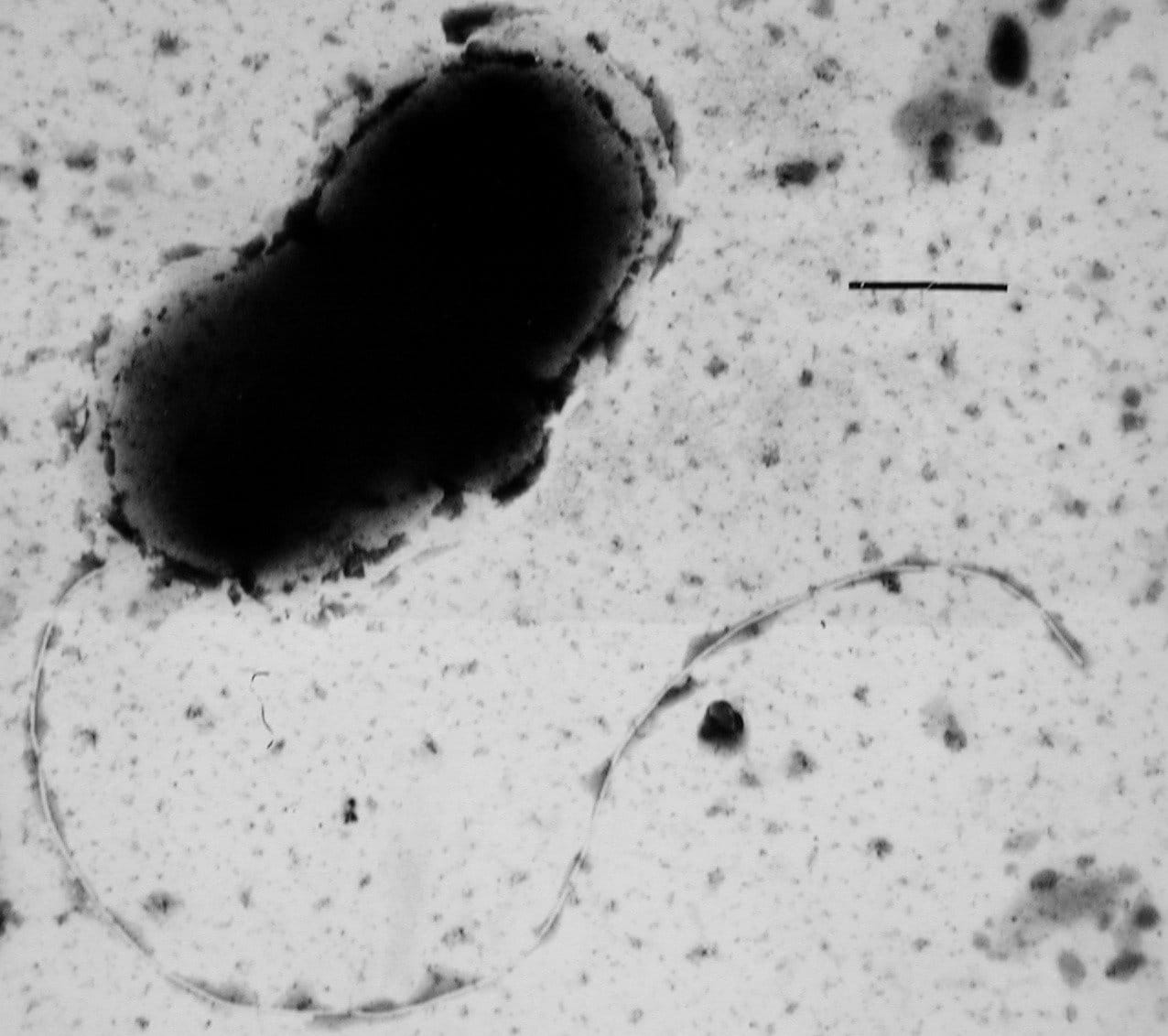 What Are Sulfate-Reducing Bacteria? - Sinymedical PRP Tube